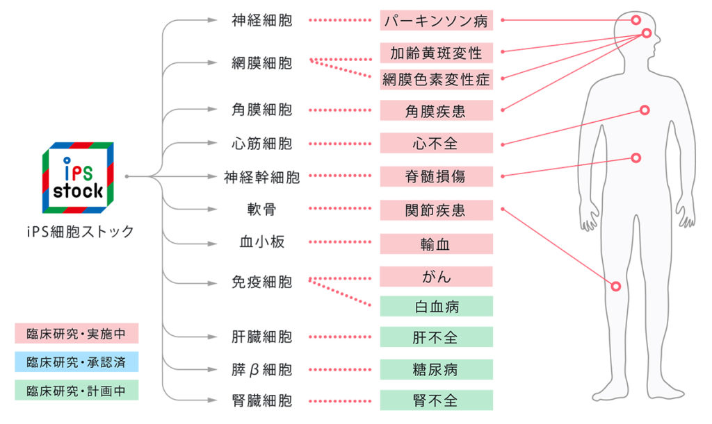 iPS細胞とは？治せる病気は？実用化するための問題点とSTAP細胞との違いもわかりやすく解説 - Spaceship Earth（スペースシップ・アース）｜SDGs・ESGの取り組み事例から私 ...